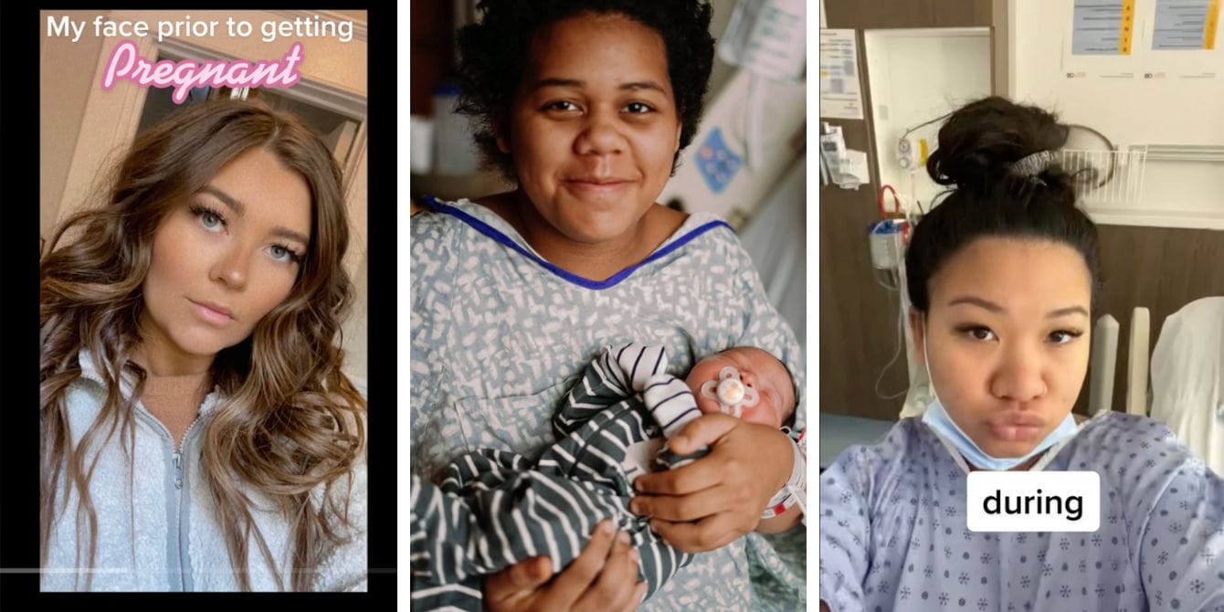 What Is Pregnancy Nose? Why It's Trending On TikTok - Motherly